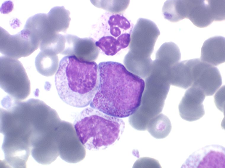 Sang normal : normes