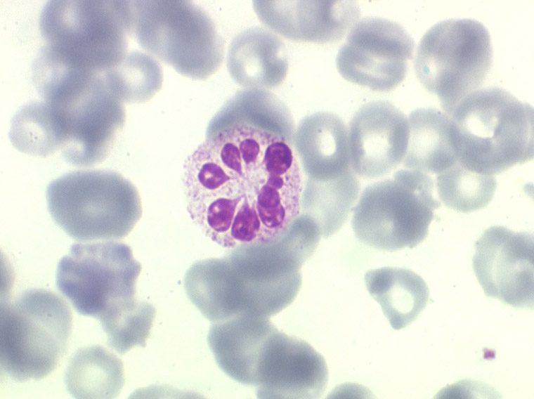 Sang normal : normes